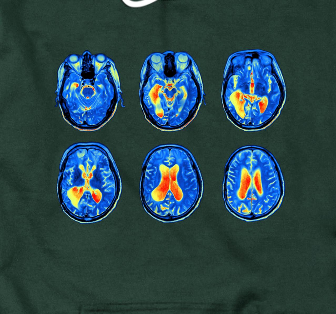 Personalized Brain Scan MRI Images of Human Brain Pullover Hoodie - All ...